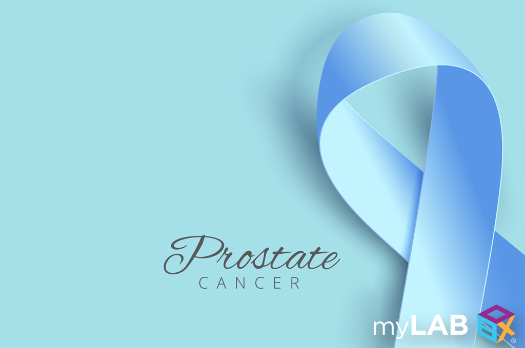 Is There a Link Between STDs and Male Prostate Cancer? | myLAB Box™